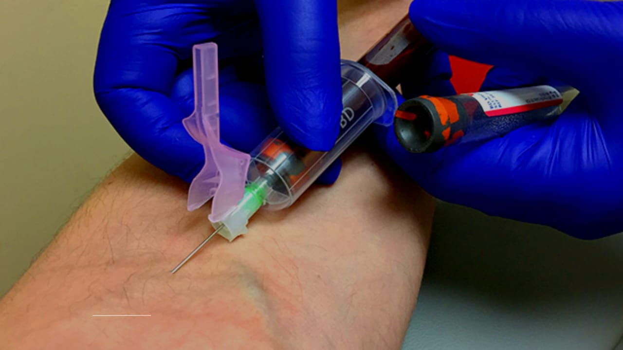 TB Testing: Skin Test vs. Blood Test Explained by Experts - Health My Live